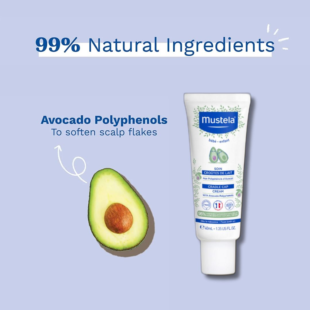 Mustela Cradle Cap Cream (40mL) – [Specific Care] – Littleblueskies ...